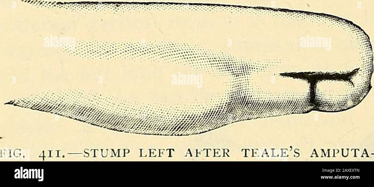 Retracted flaps hi-res stock photography and images - Alamy