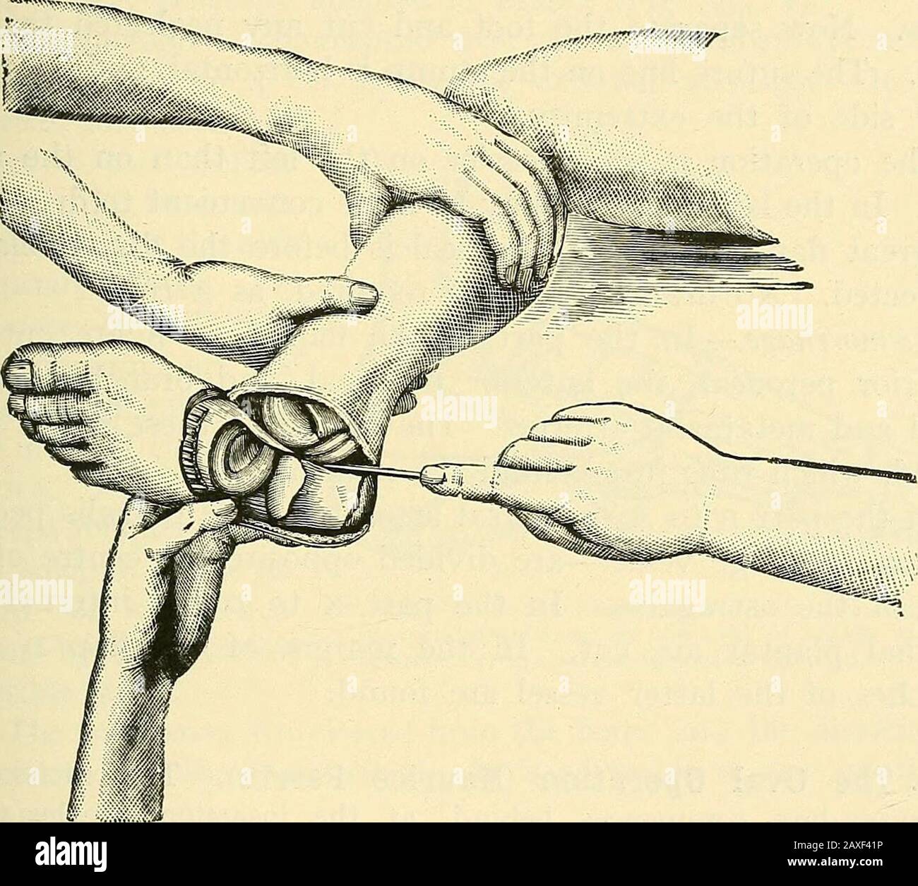 Knifethe hi-res stock photography and images - Alamy