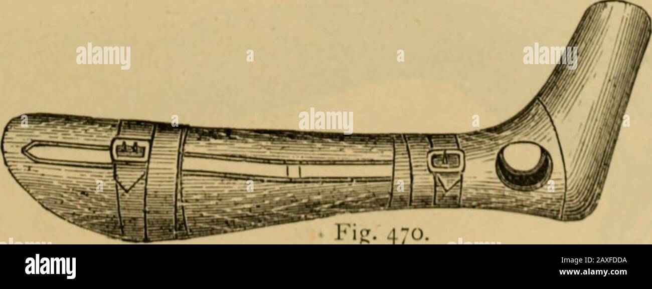 Leg splints hi-res stock photography and images - Alamy