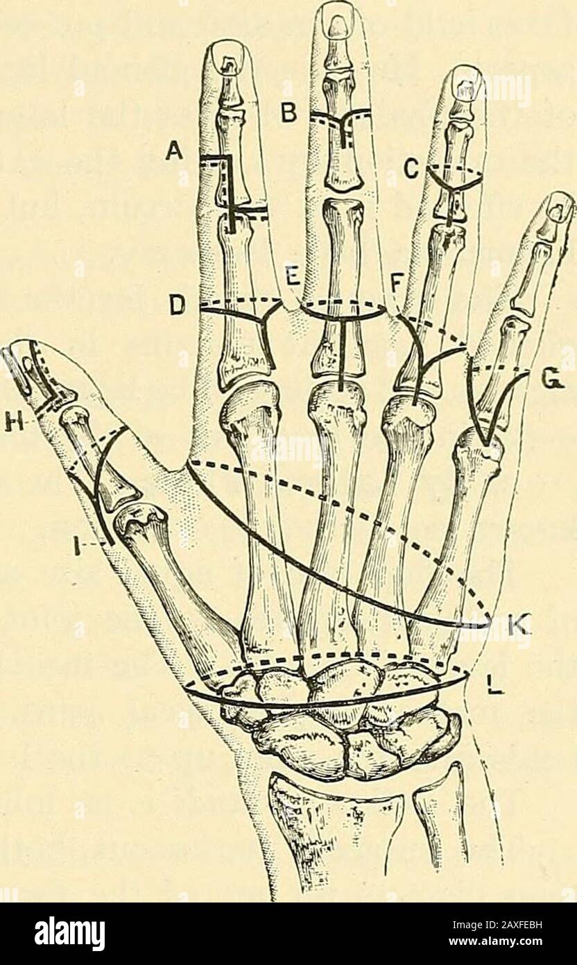 A manual of operative surgery . scribedcorresponds to the French ...