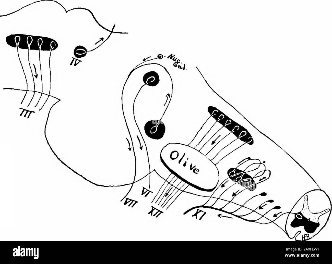 Longitudinal Axis Needling