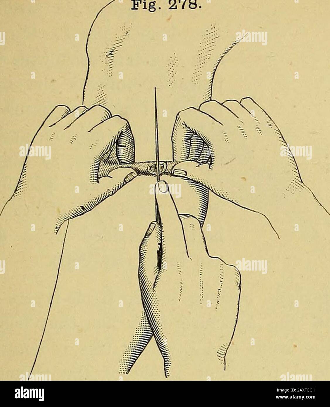 The surgeon's handbook on the treatment of wounded in war : a prize ...