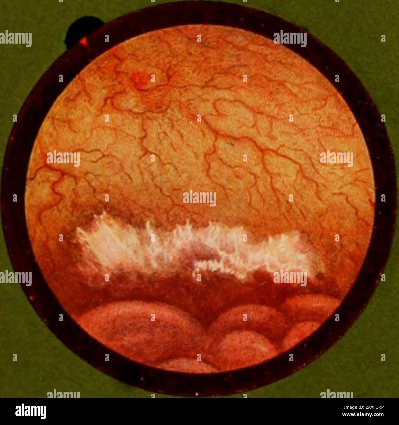 Traitâe pratique de cystoscopie et de cathâetâerisme urâetâeral . Fia ...