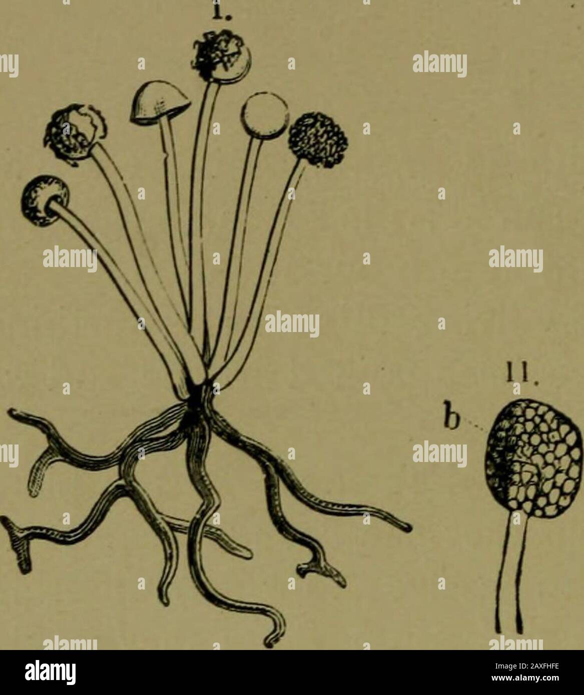 Diphtheria throat hi-res stock photography and images - Alamy