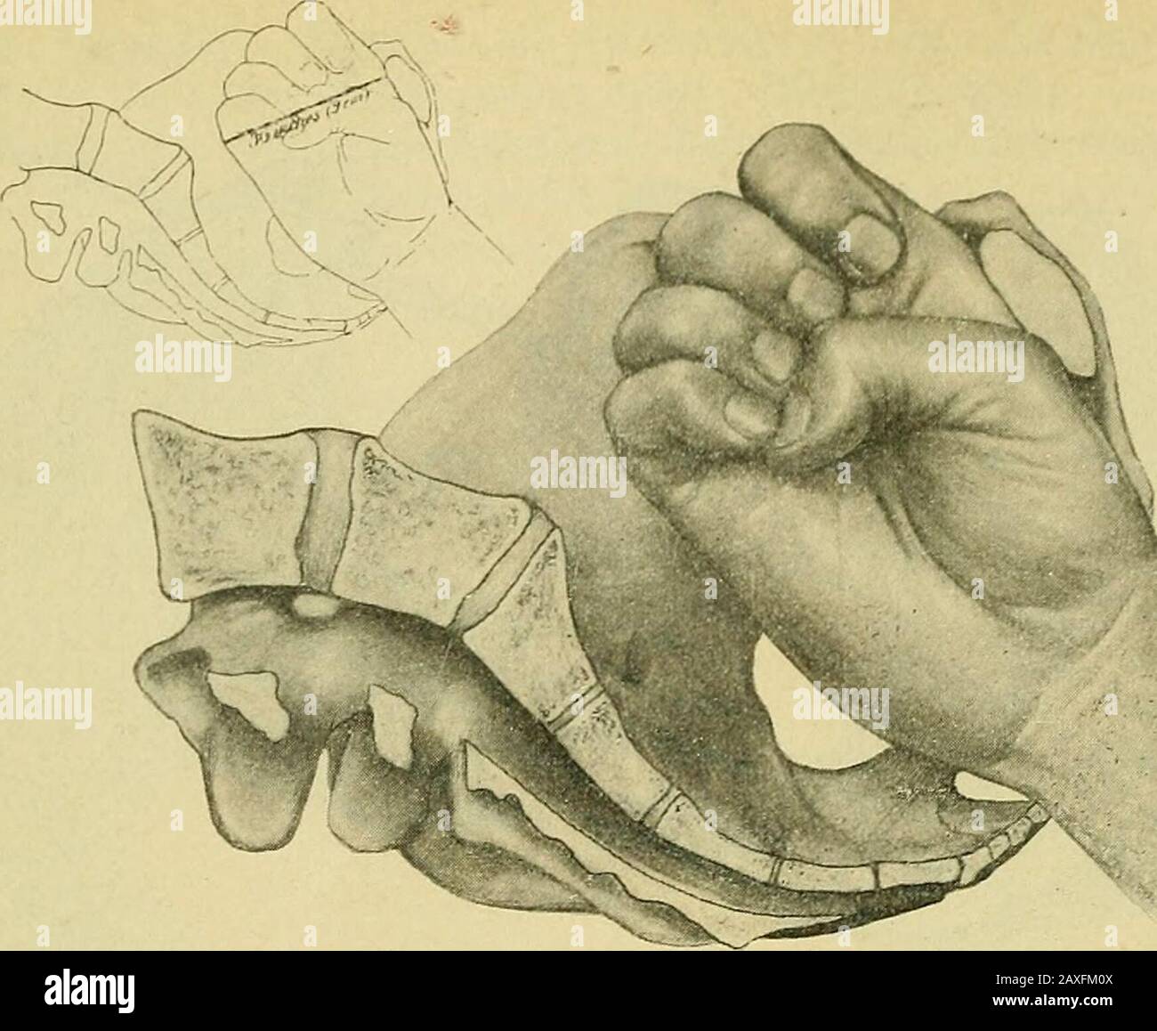 Pelvimetry hi-res stock photography and images - Alamy