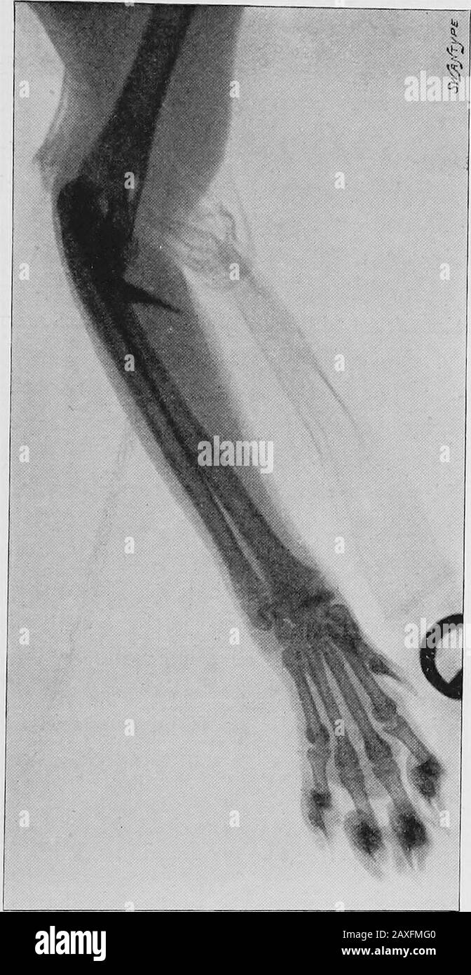 Townsthe hi-res stock photography and images - Alamy