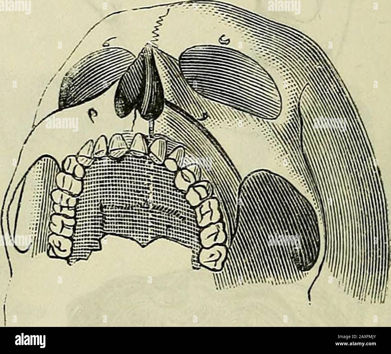 Os dans le nez hi-res stock photography and images - Alamy