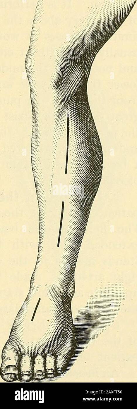 Connective tissue leg hi-res stock photography and images - Alamy