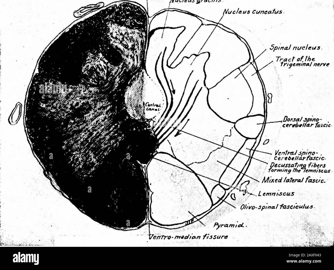 Ventral lateral nucleus Black and White Stock Photos & Images - Alamy