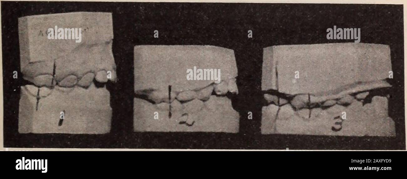 Arch positions hi-res stock photography and images - Alamy
