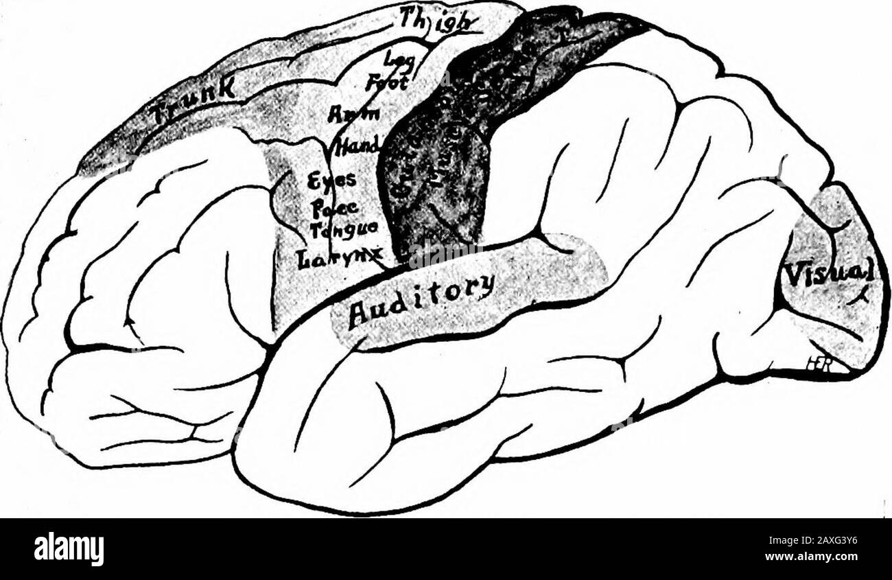Lateral ventricle hi-res stock photography and images - Alamy