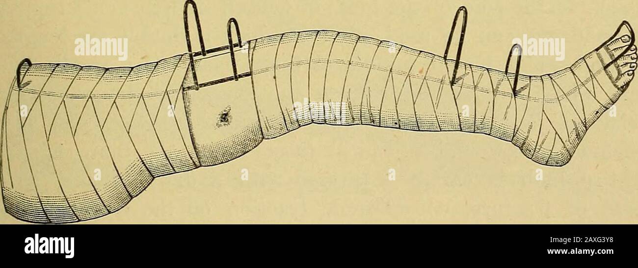 The surgeon's handbook on the treatment of wounded in war : a prize ...
