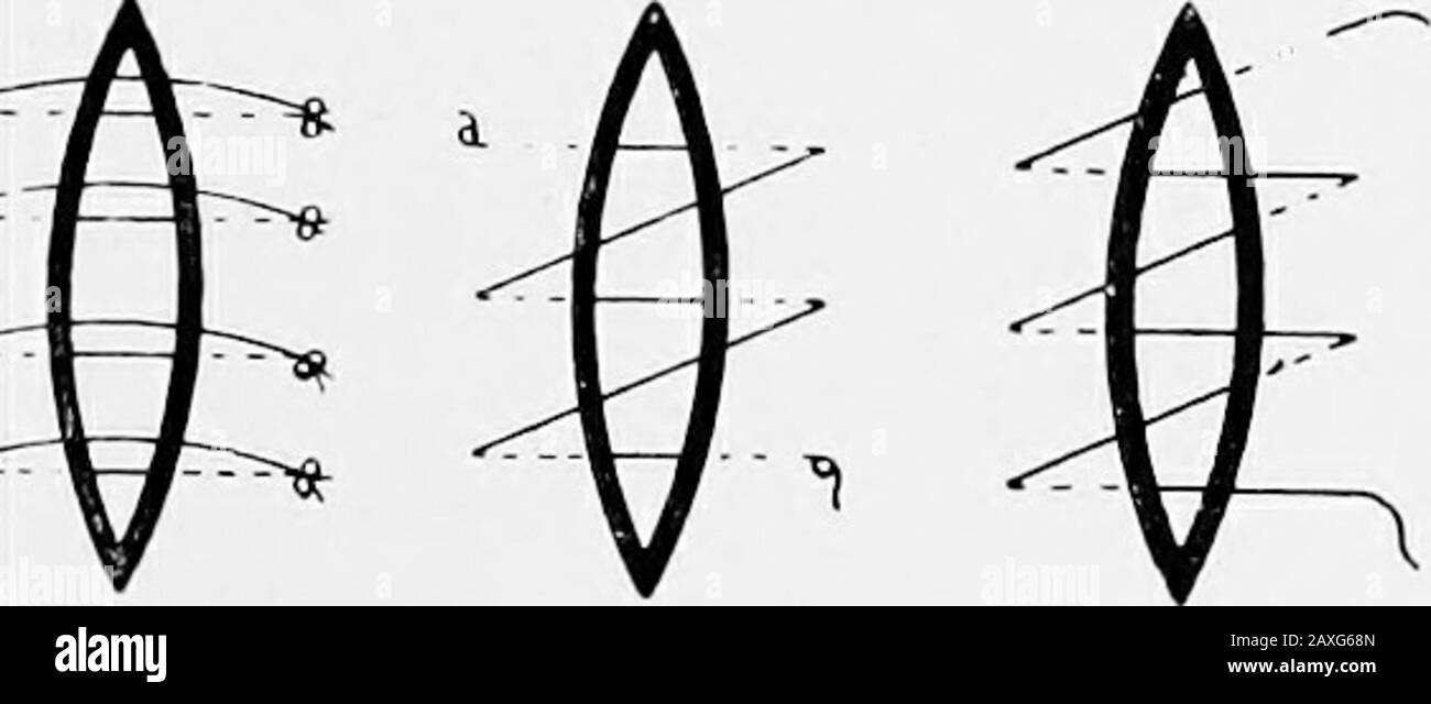 Canine and feline surgery .. . arnolds sons london Fig. 25.Suture ...