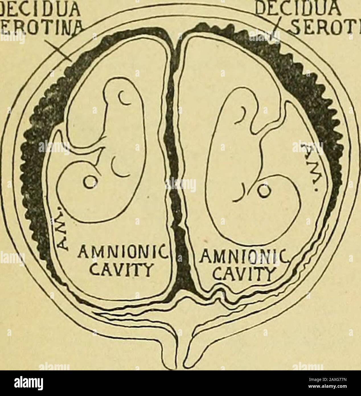 Twins embryo hi-res stock photography and images - Alamy