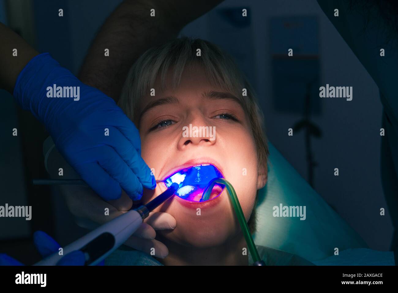 Closeup dental examination with ultraviolet light on a female patient ...
