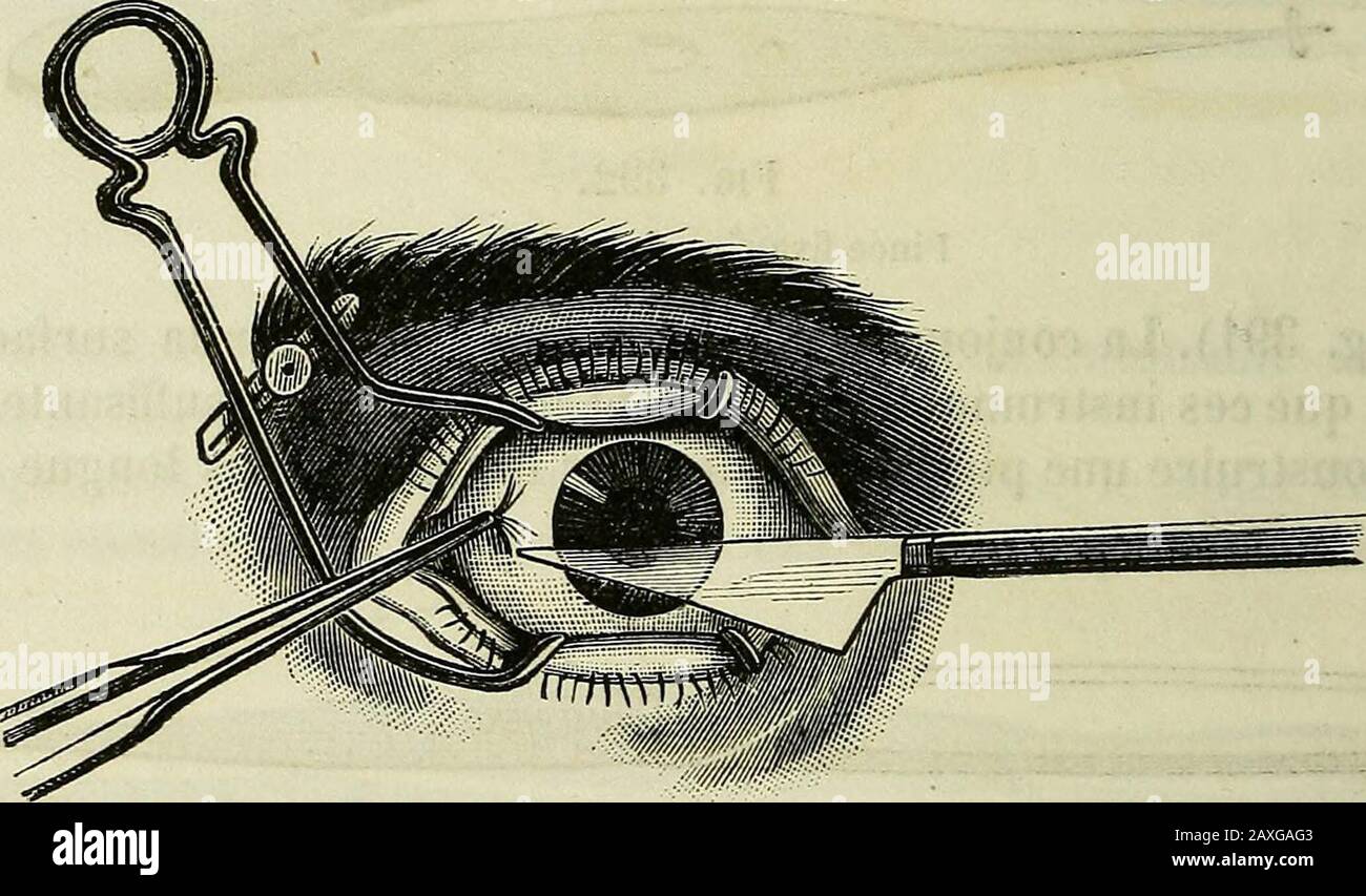 Il poursuit hi-res stock photography and images - Alamy