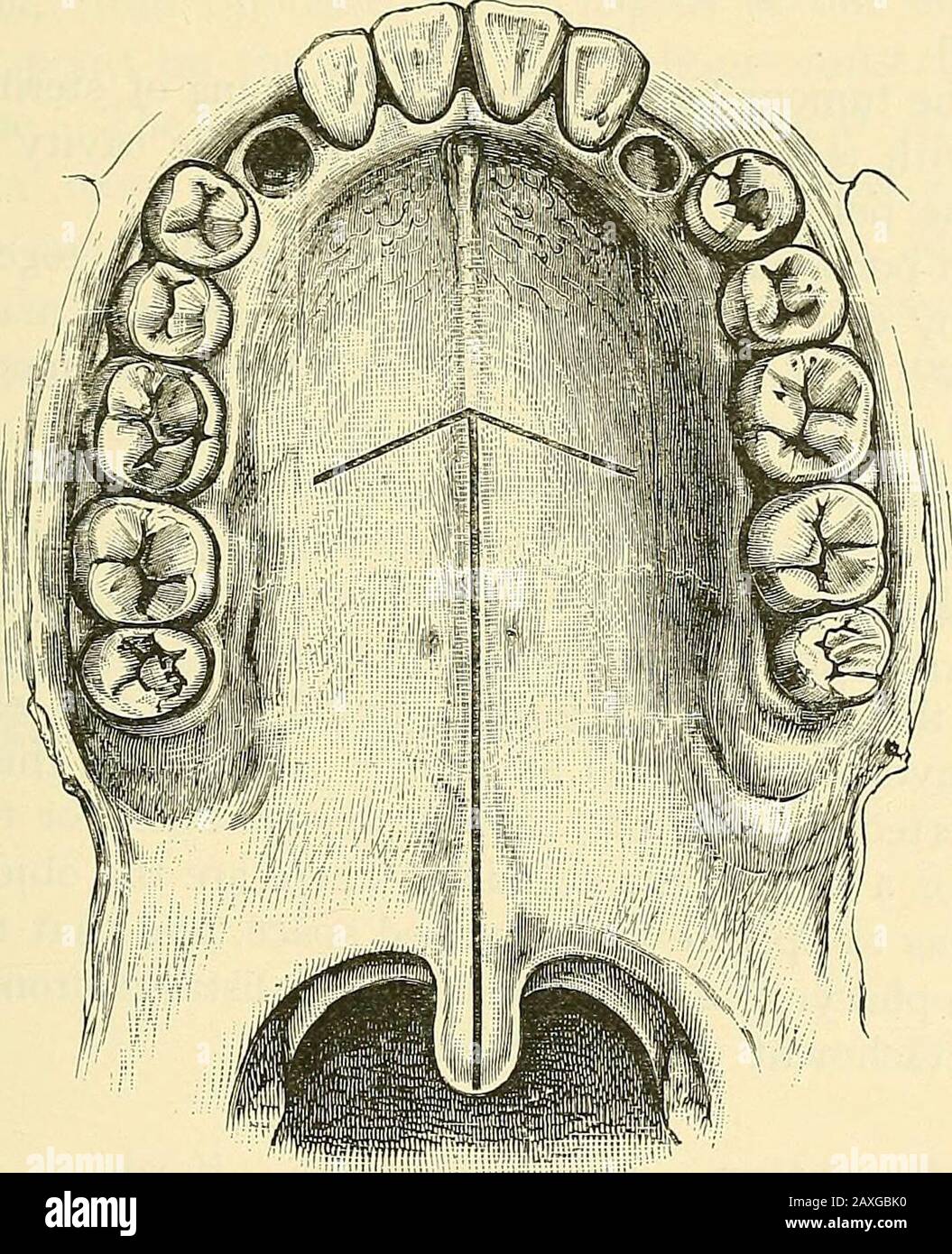 Nasal mucous membrane hi-res stock photography and images - Alamy