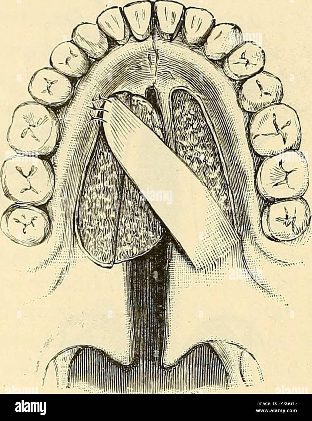 Separated palate hi-res stock photography and images - Alamy