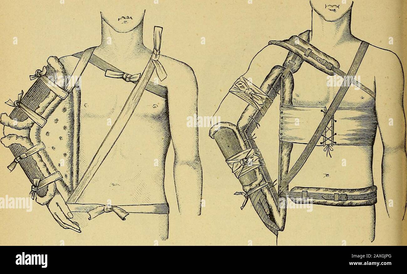 Bandages arm in sling hi-res stock photography and images - Alamy