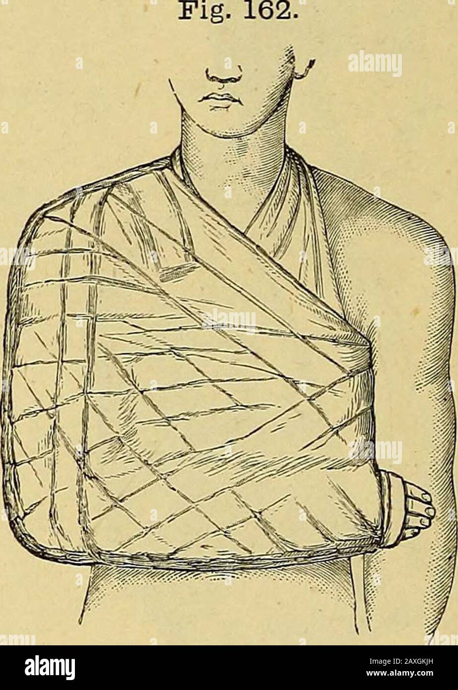 Bandages arm in sling hi-res stock photography and images - Alamy