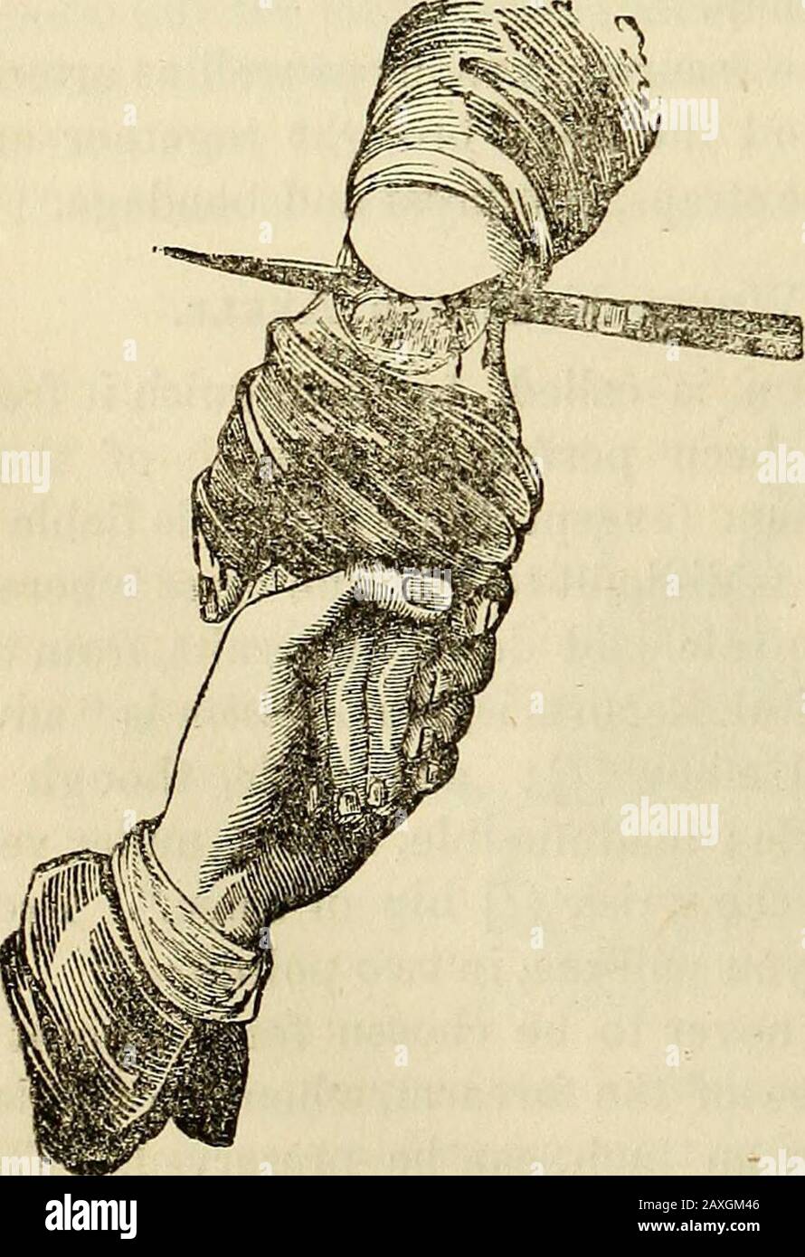 Olecranon process hi-res stock photography and images - Alamy