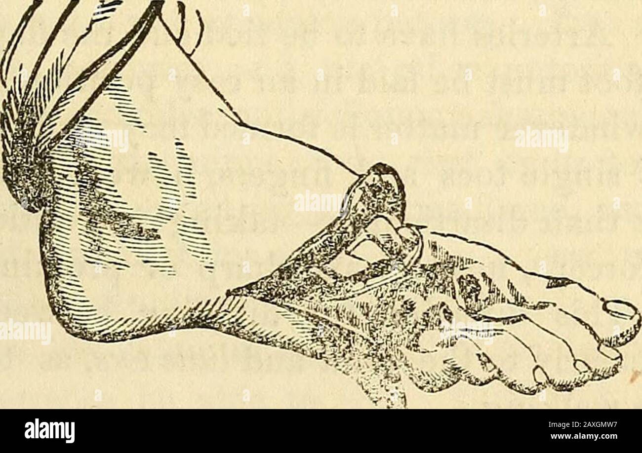 Foot flaps hi-res stock photography and images - Alamy