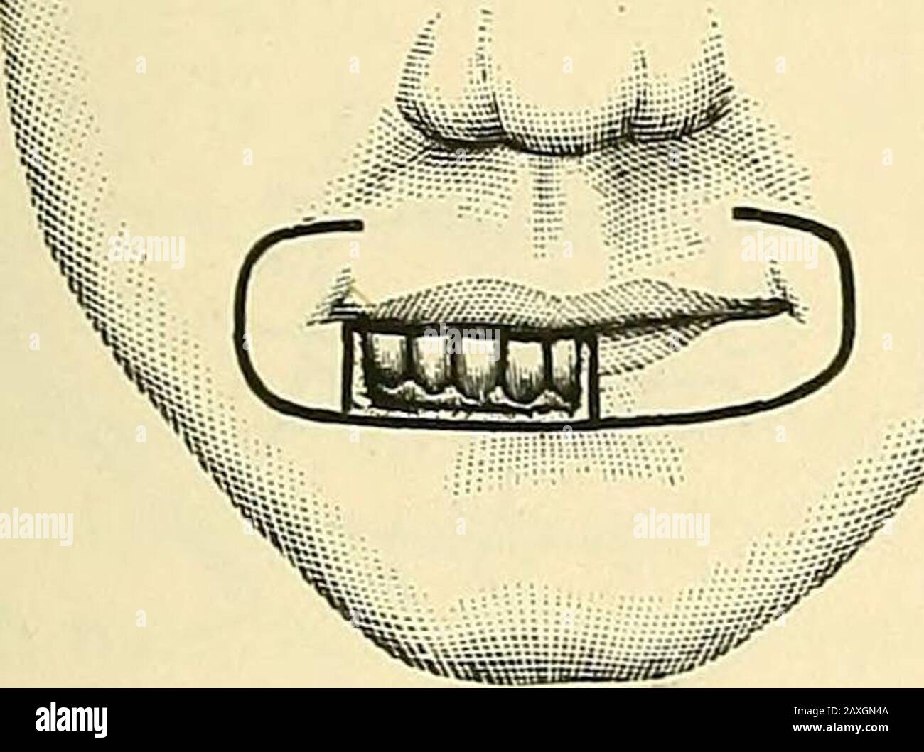 Upper lip shown hi-res stock photography and images - Alamy