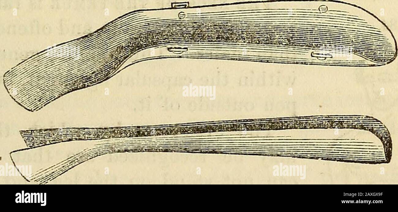 Anchylosis hi-res stock photography and images - Alamy