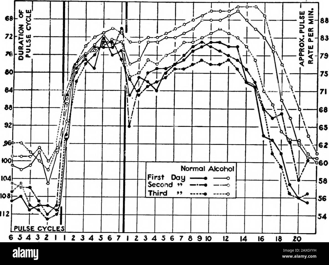 Respiration rate Black and White Stock Photos & Images - Alamy