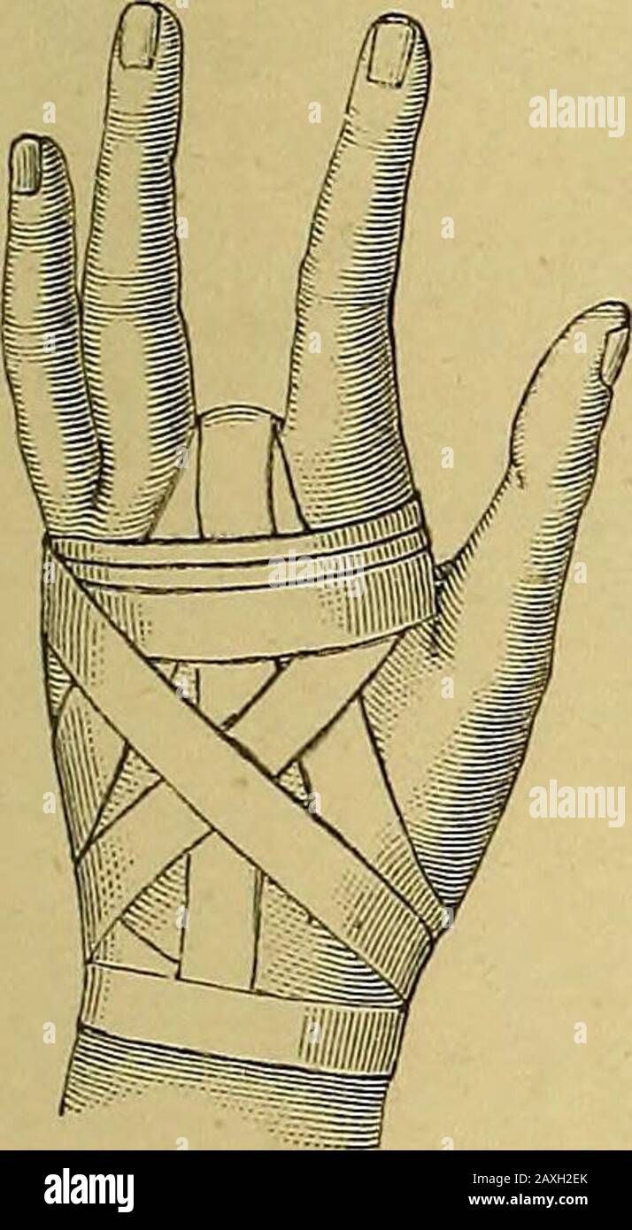 Narrow bandages applied hi-res stock photography and images - Alamy