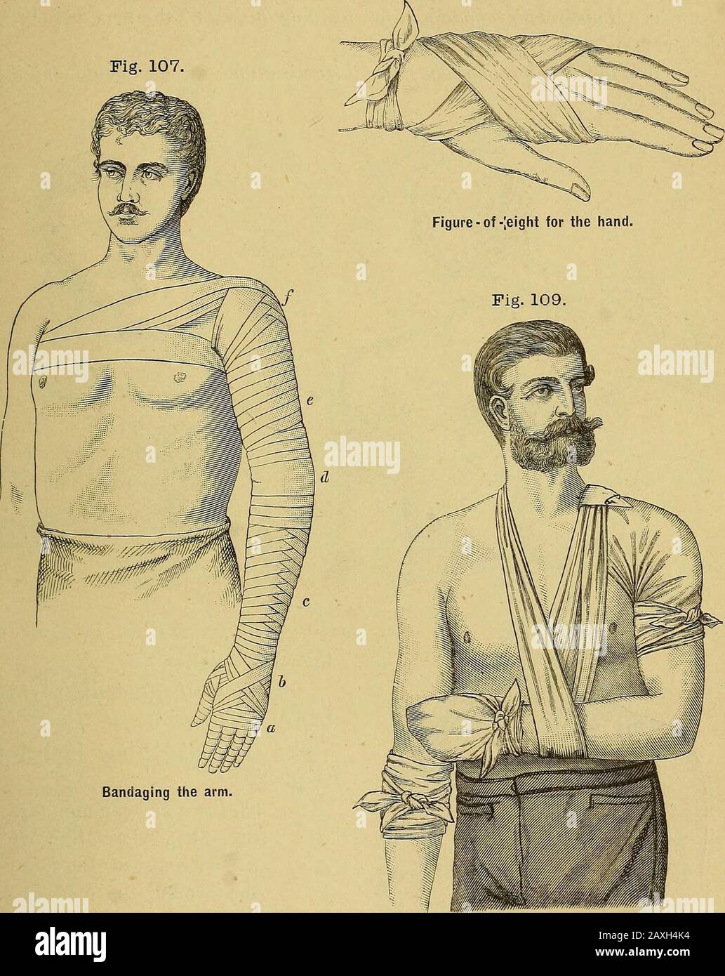 Shoulder bandages hi-res stock photography and images - Alamy