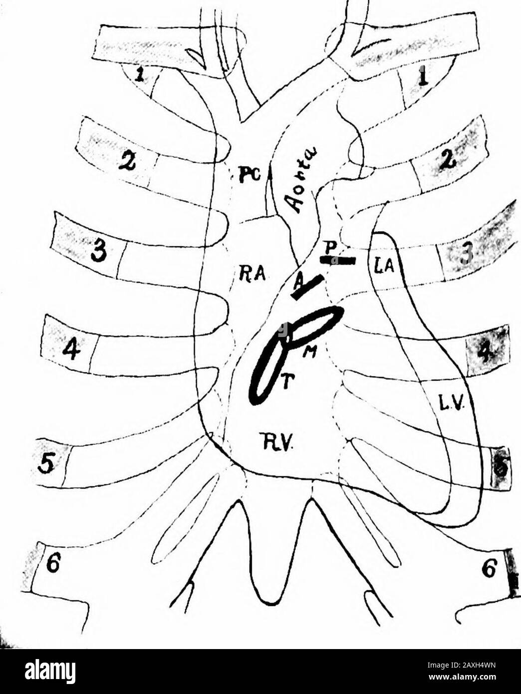 A manual of anatomy . ted as follows: The pulmonary valve is placed ...