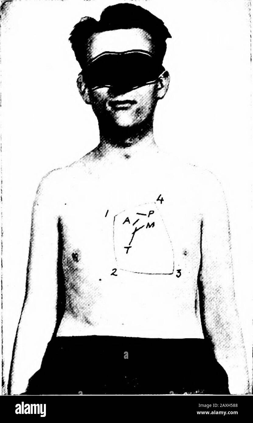 Two fold system hi-res stock photography and images - Alamy