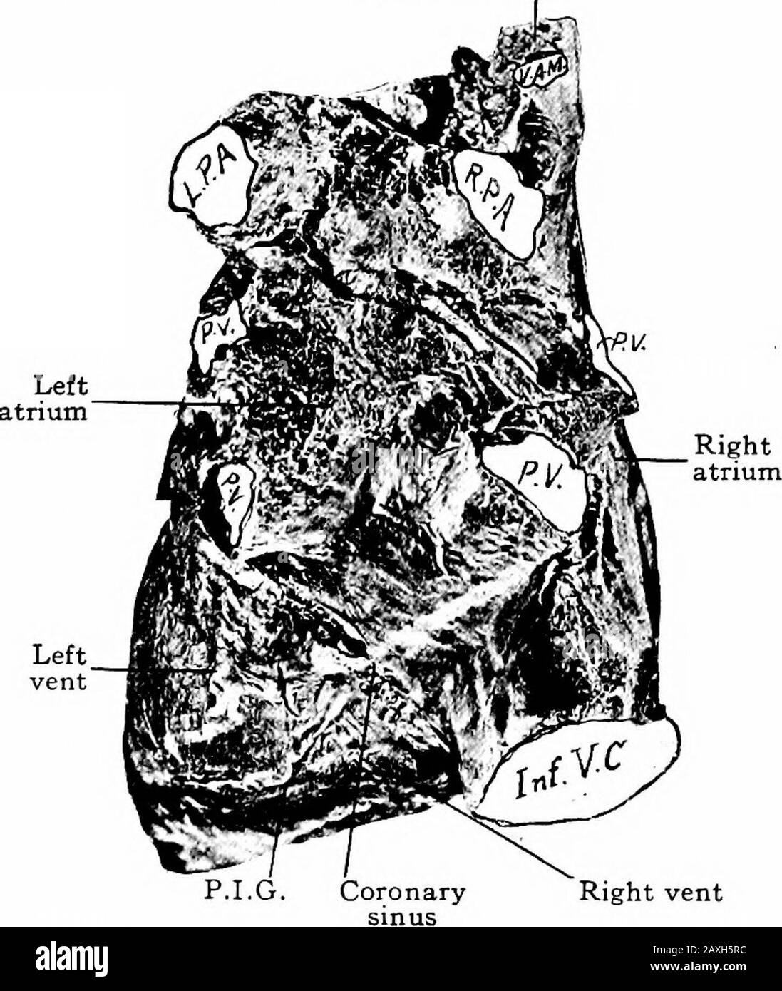 Muscular system in female anatomy Black and White Stock Photos & Images ...