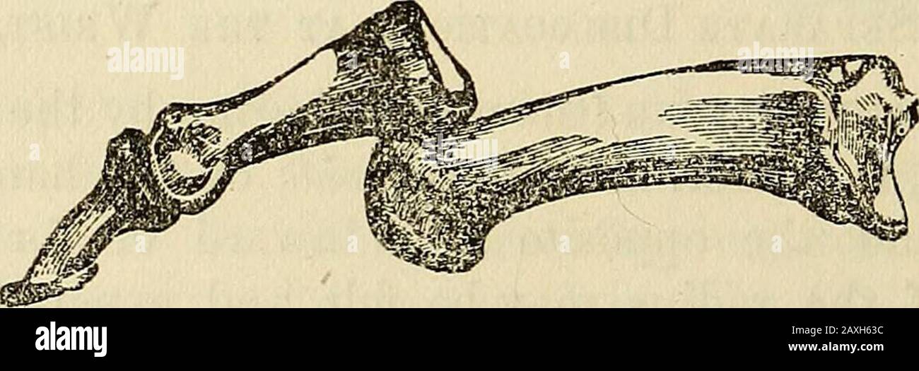 Styloid process hi-res stock photography and images - Alamy