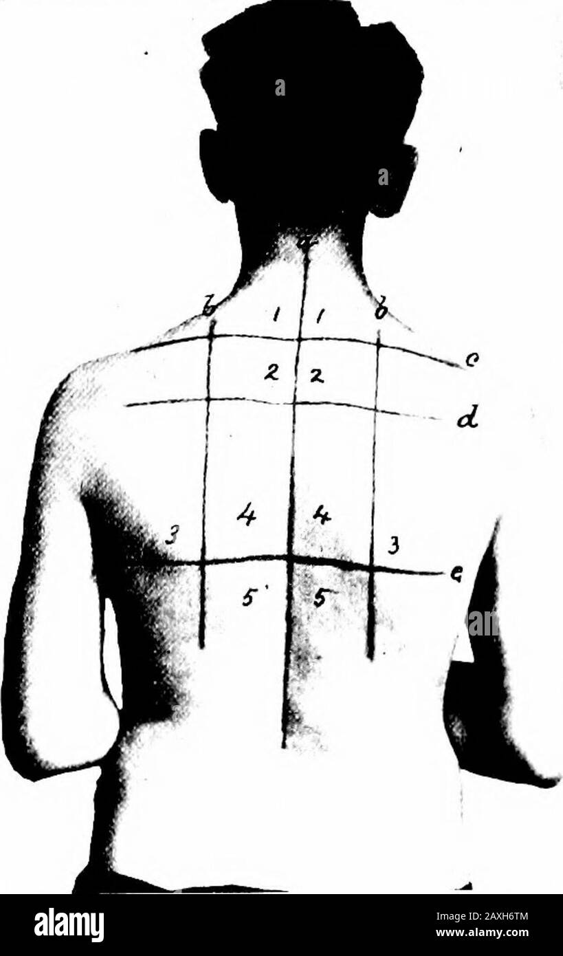 Medial border hi-res stock photography and images - Alamy