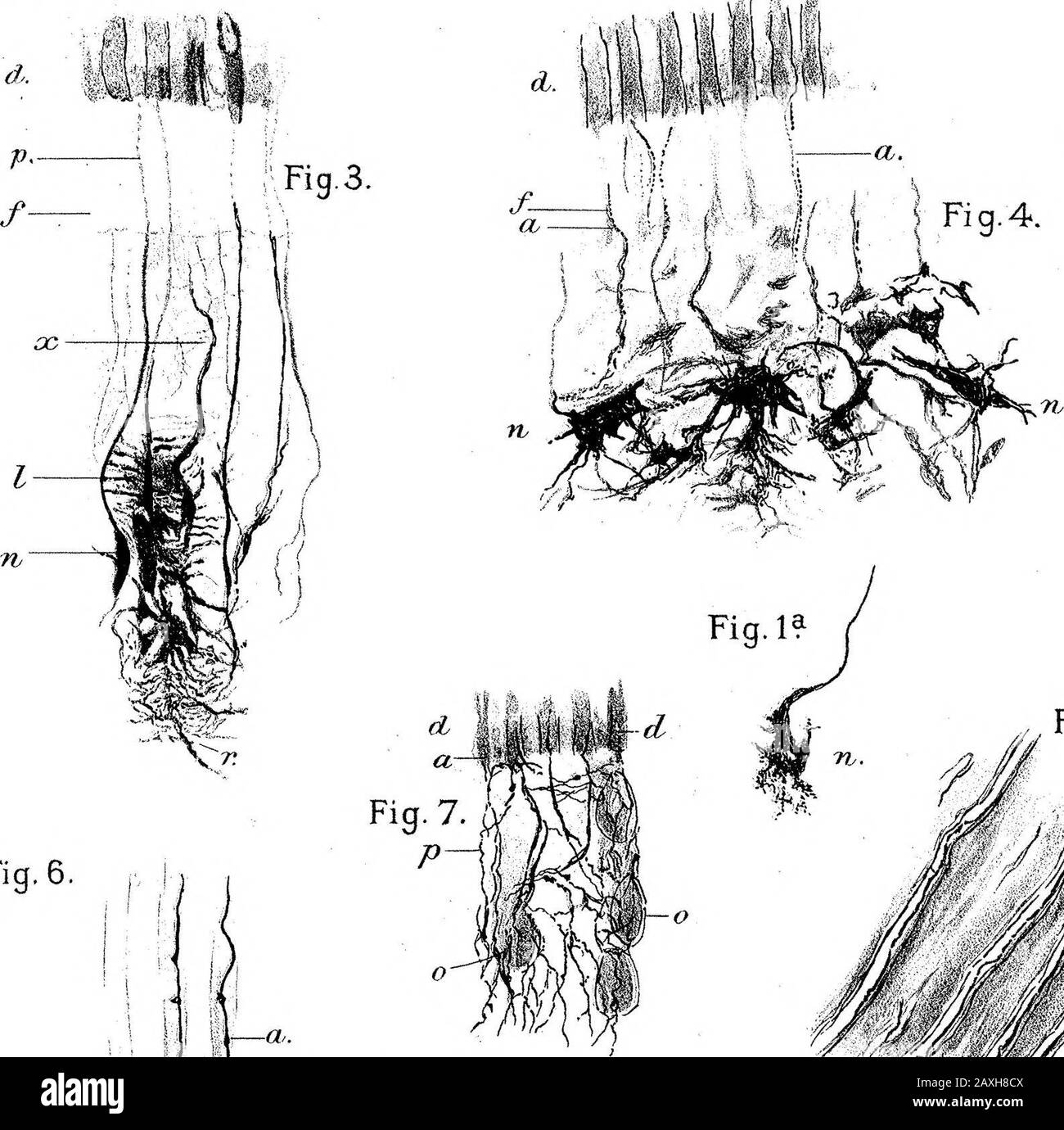 Neurofibrils