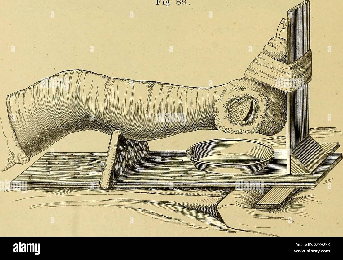 Wound secretion hi-res stock photography and images - Alamy