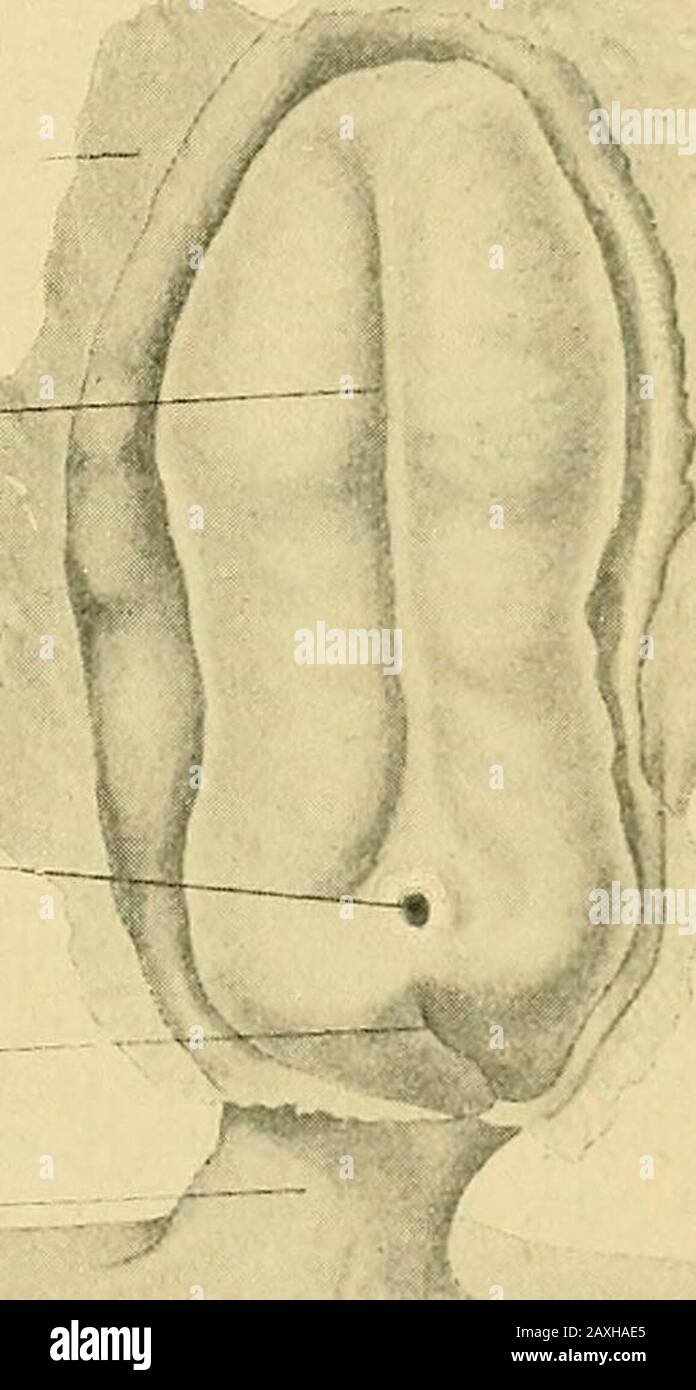 Allantoic stalk hi-res stock photography and images - Alamy