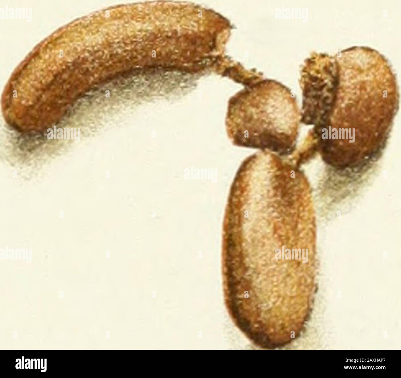 Rectal cyst hi-res stock photography and images - Alamy