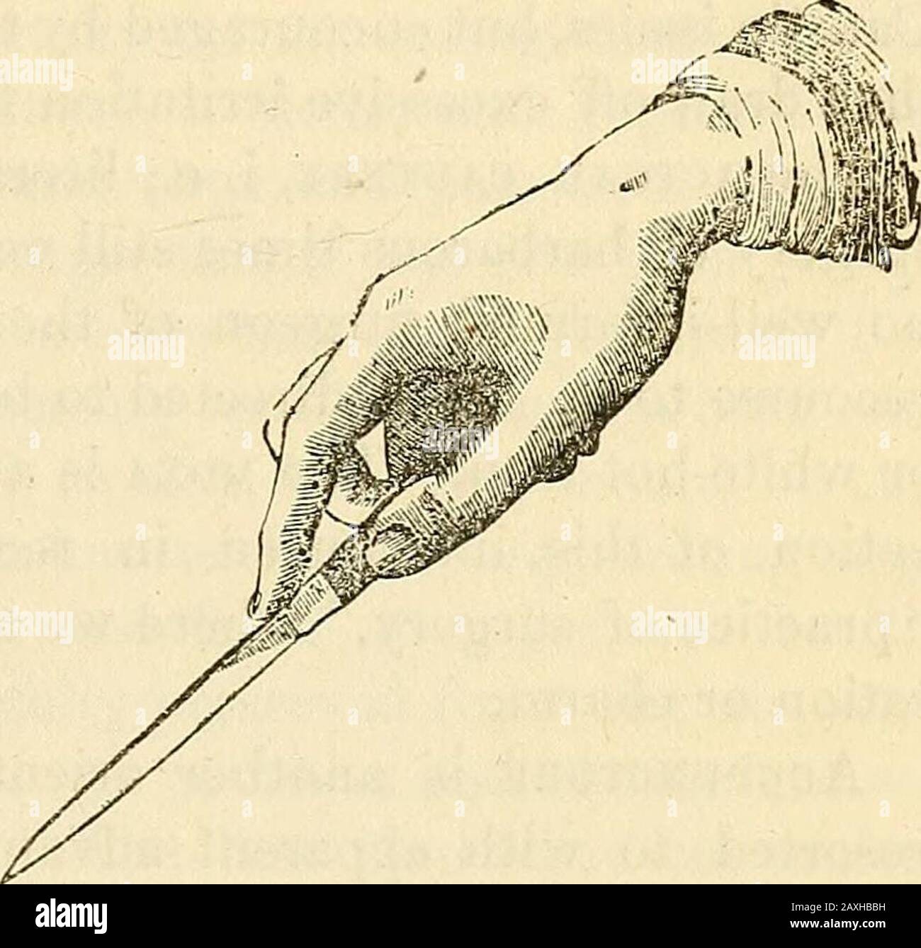 Tenaculum hi-res stock photography and images - Alamy