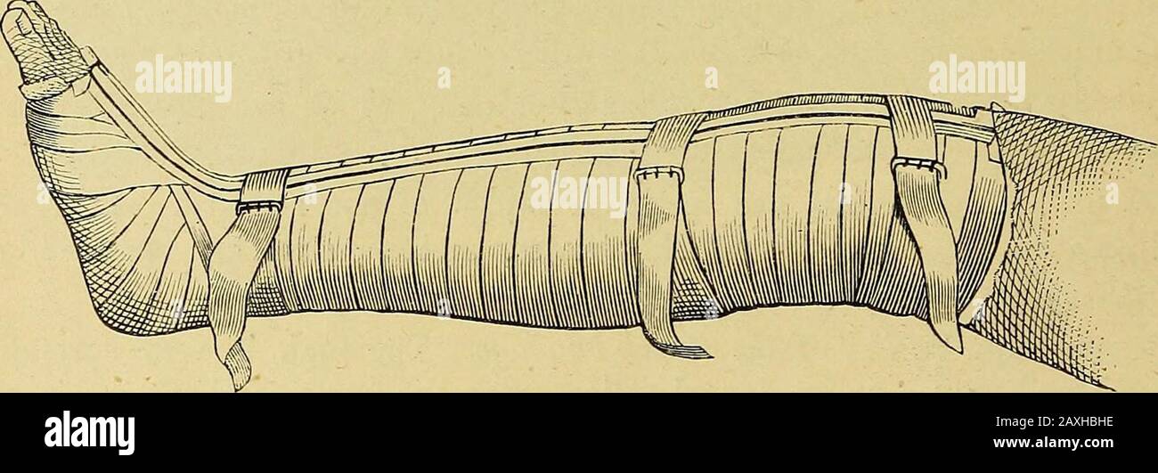 Ascending limb hi-res stock photography and images - Alamy