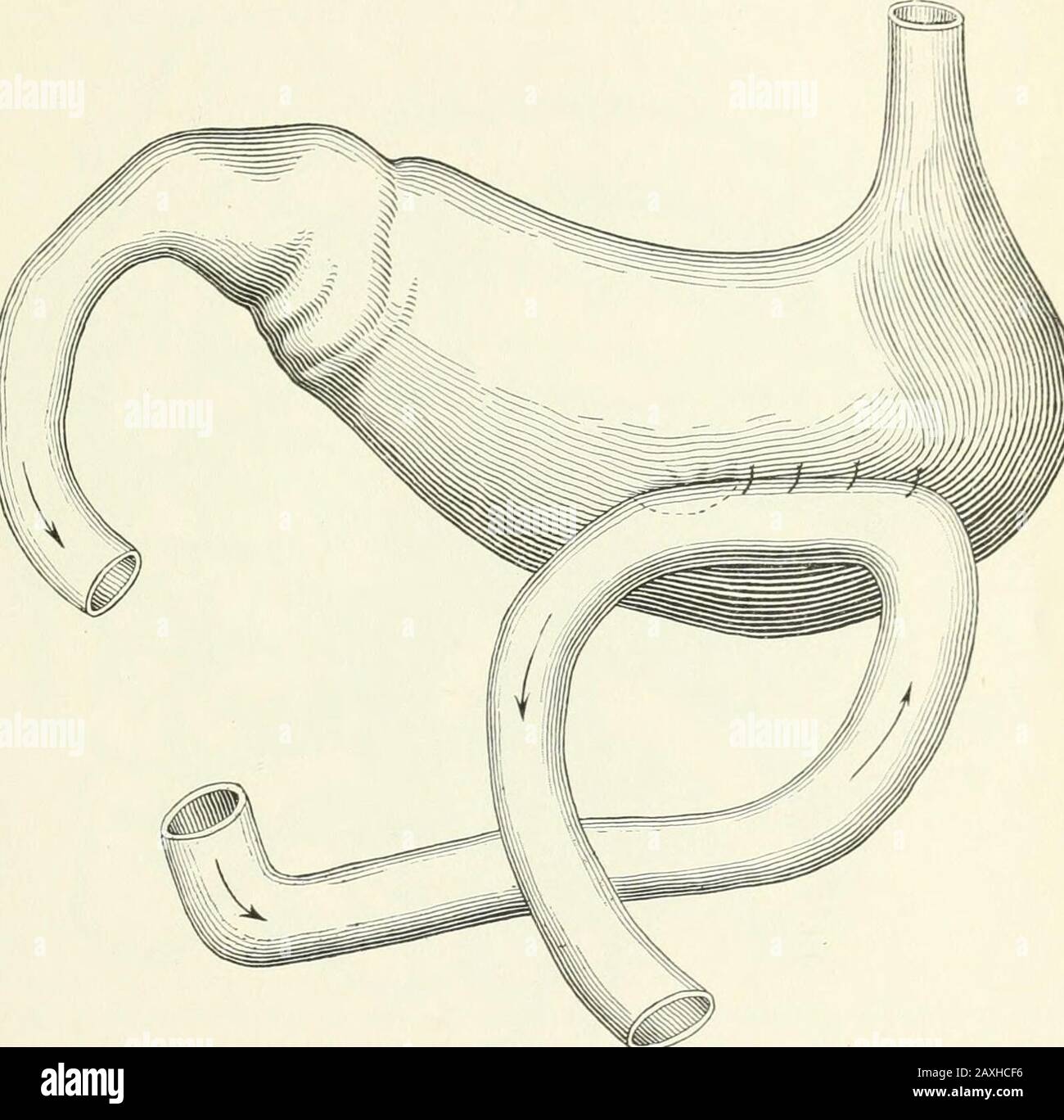 Stomach stitches hi-res stock photography and images - Alamy