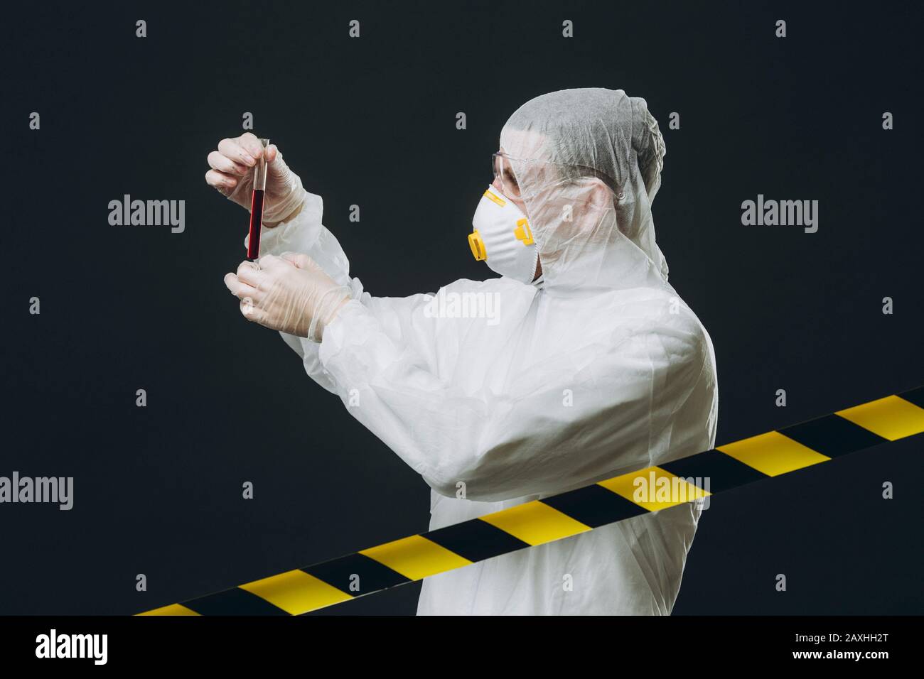 The epidemiologist collects specimens for infection in the infection ...