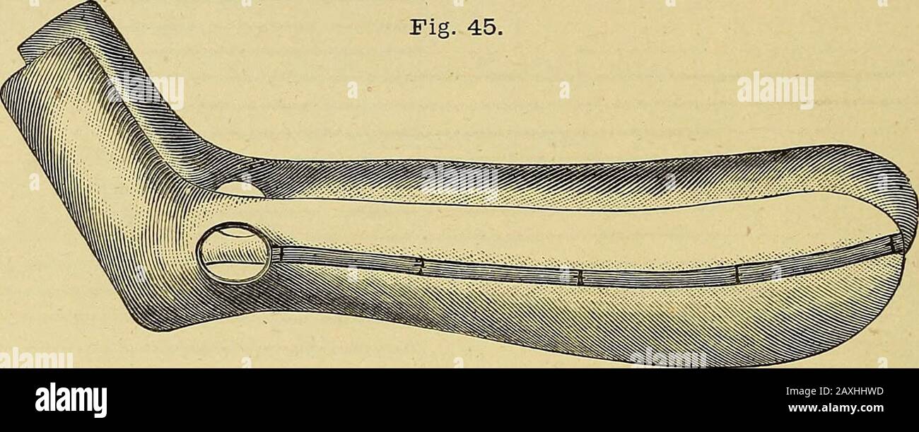 Wooden splints hi-res stock photography and images - Alamy