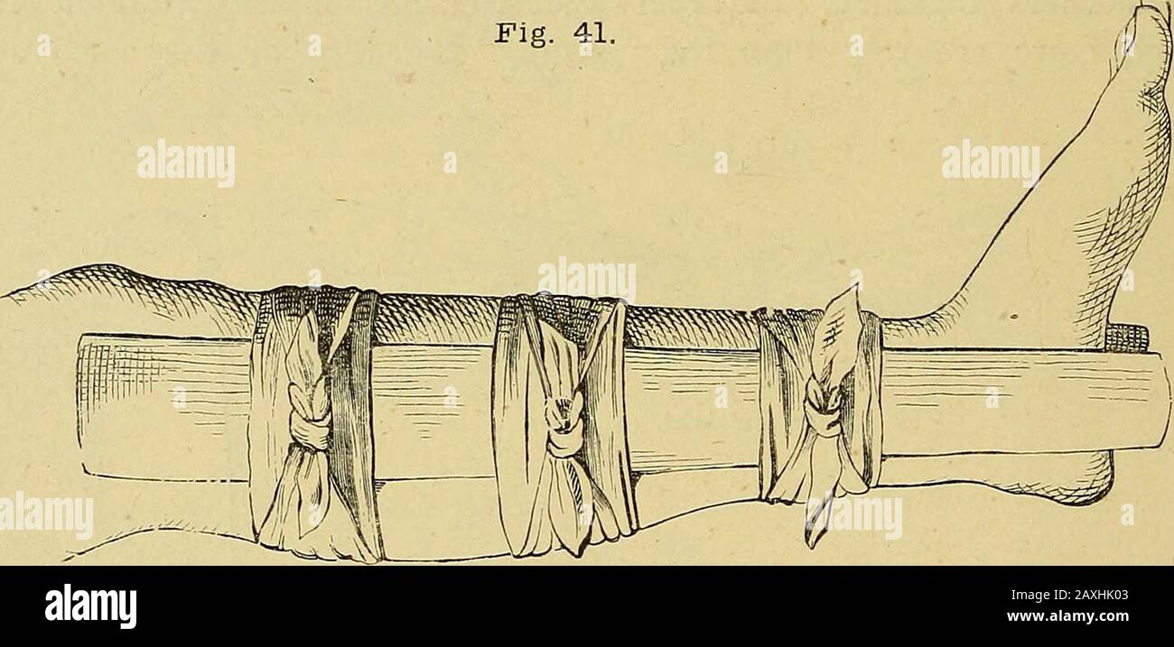 The surgeon's handbook on the treatment of wounded in war : a prize ...