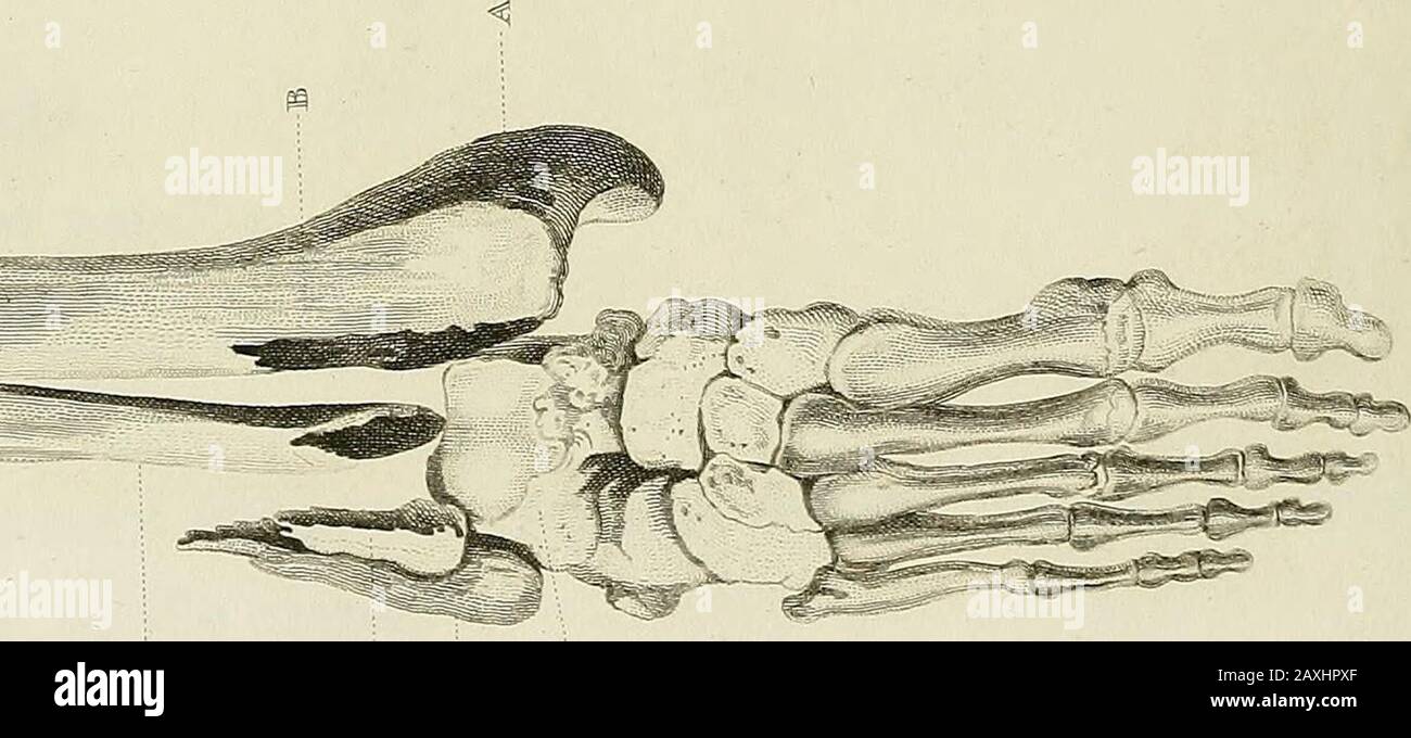 F c c tibia hi-res stock photography and images - Alamy