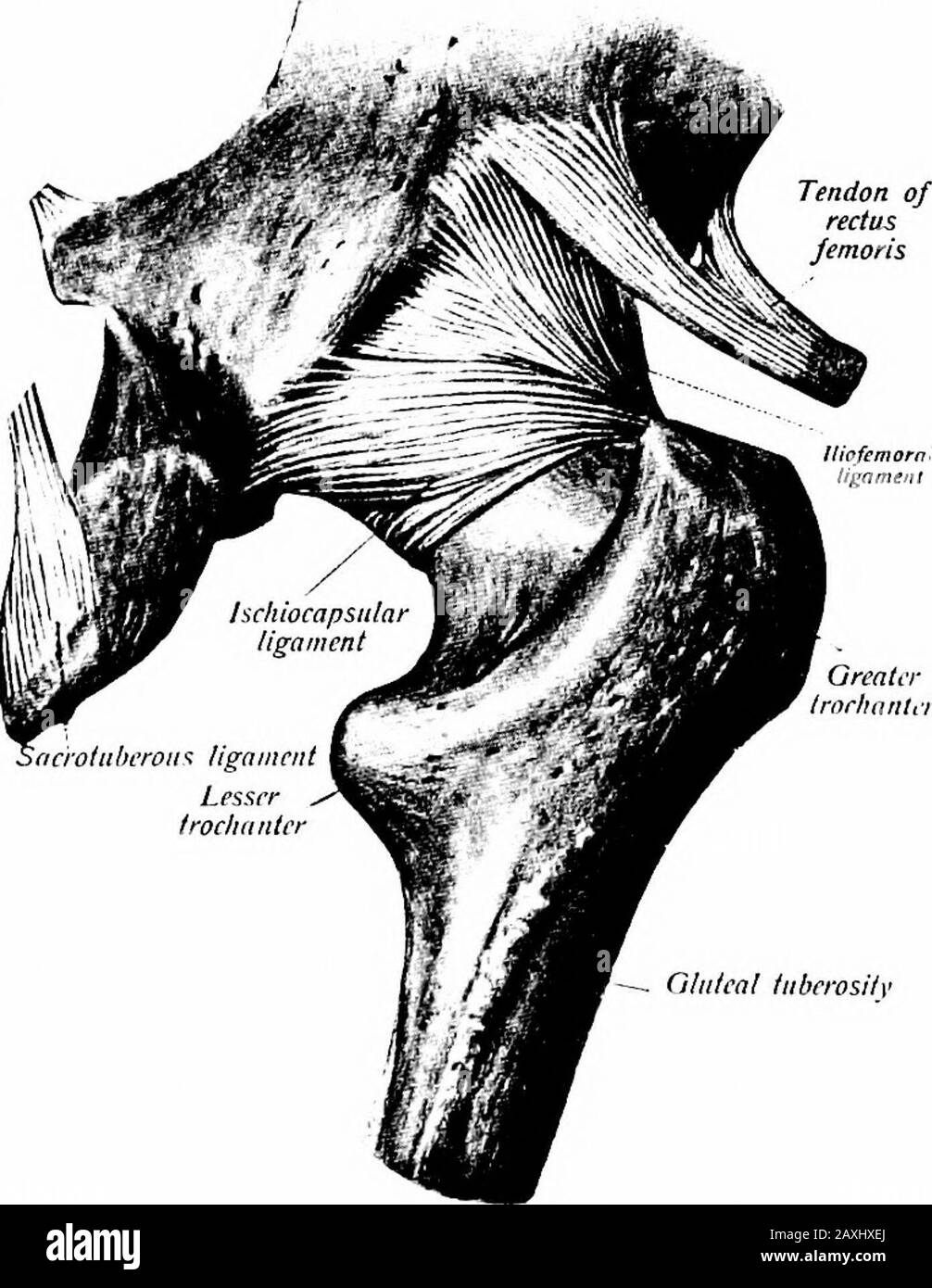 Greater trochanter hi-res stock photography and images - Alamy