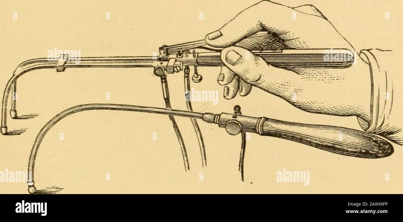 Sponge electrode hi-res stock photography and images - Alamy