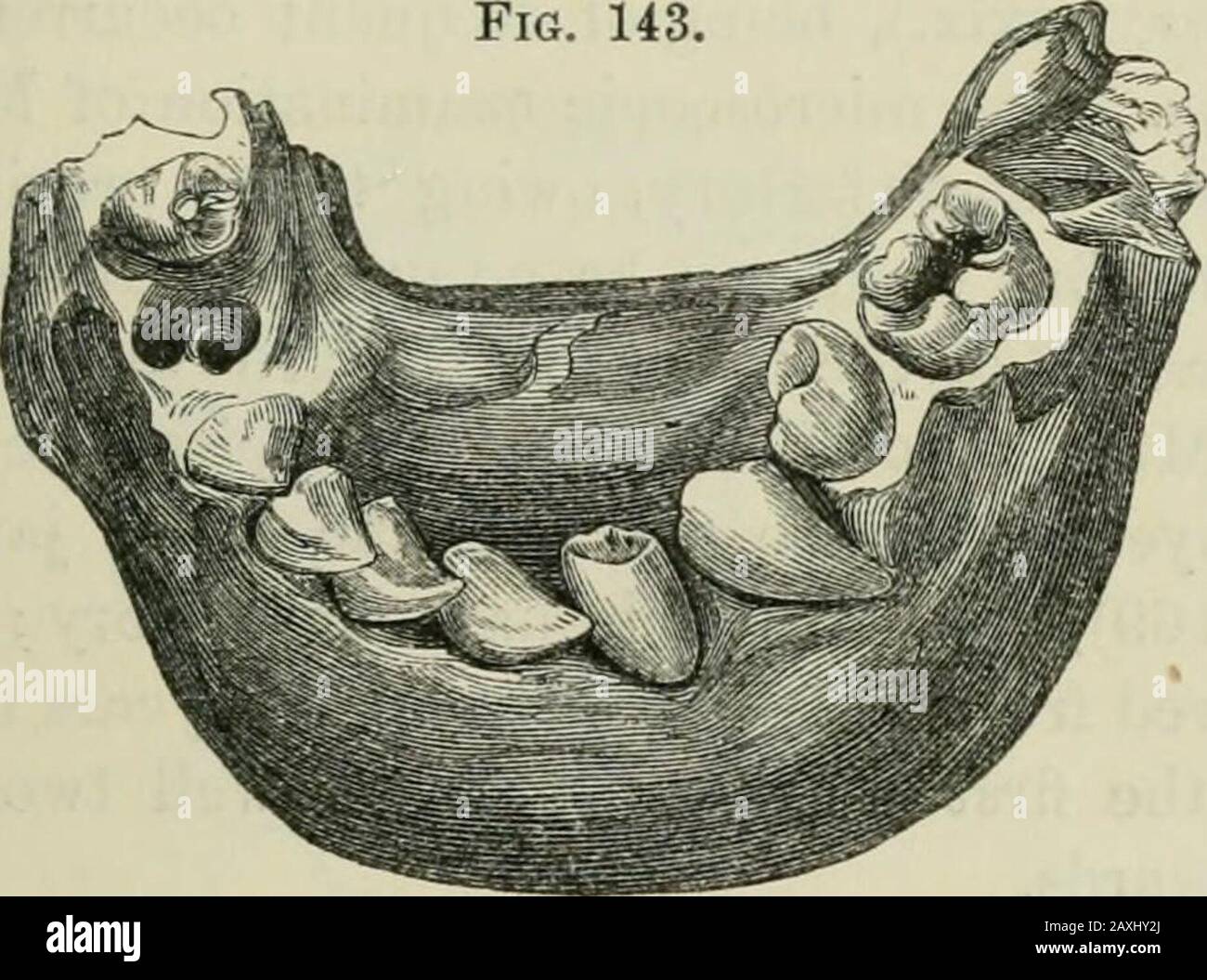 Myeloid tissue hi-res stock photography and images - Alamy